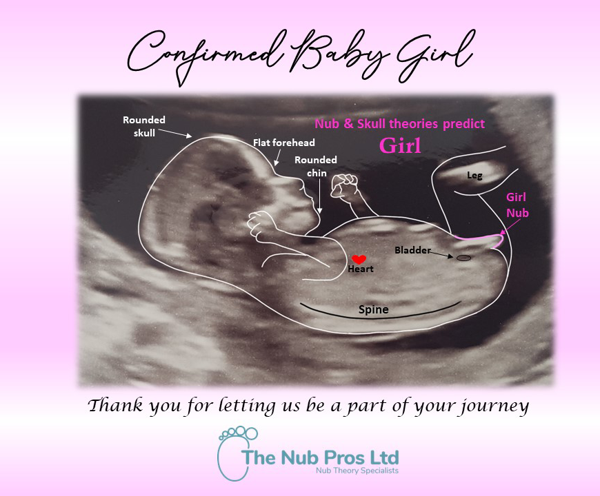 The Nub Theory - The Nub Pros Ltd